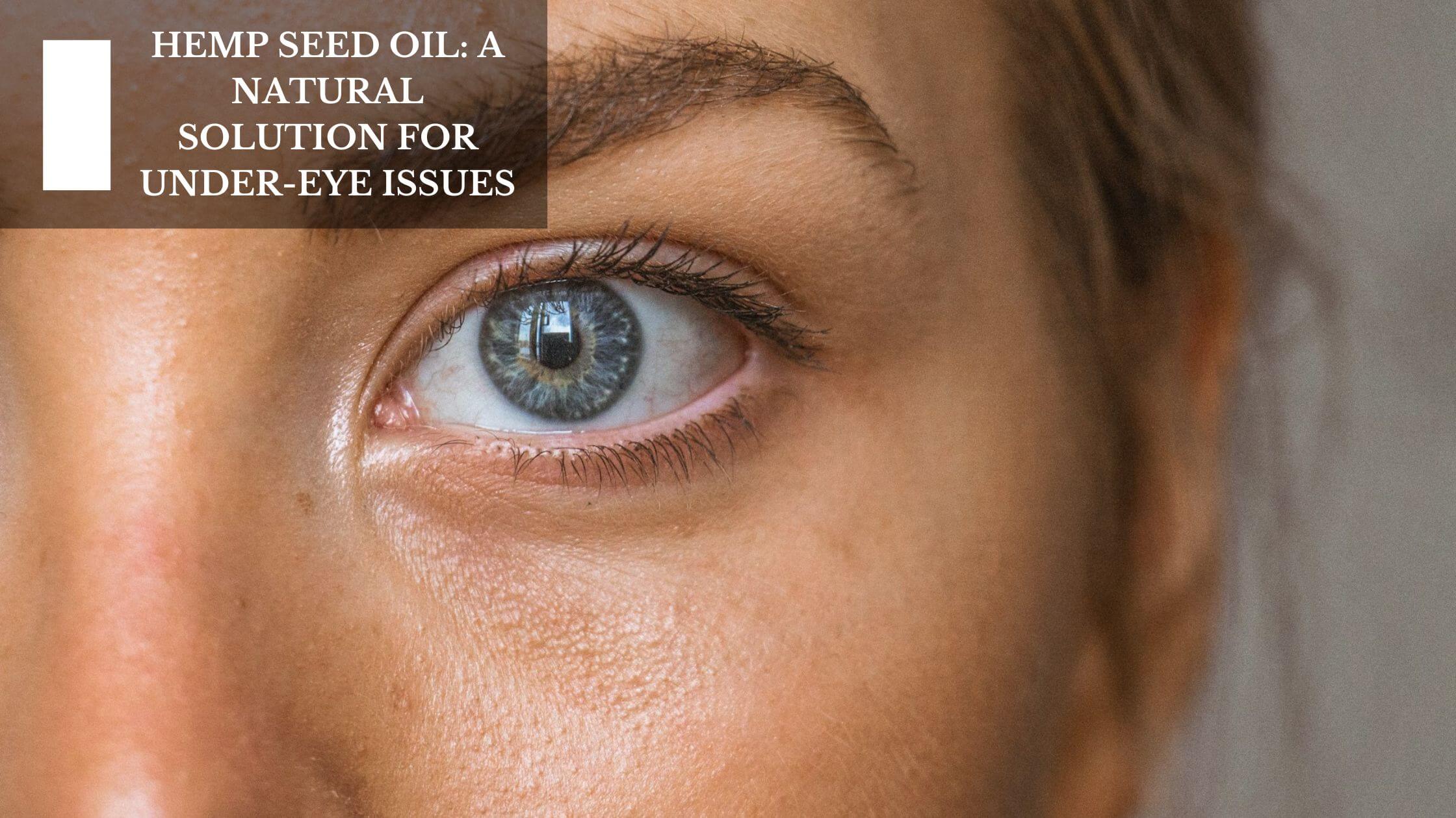 Hemp Seed Oil: A Natural Solution For Under Eye Issues – Moksha ...