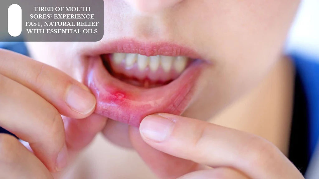 Tired Of Mouth Sores? Experience Fast, Natural Relief With Essential ...